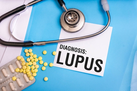 Penyakit Lupus: Definisi dan Pengenalan - Magelang Online